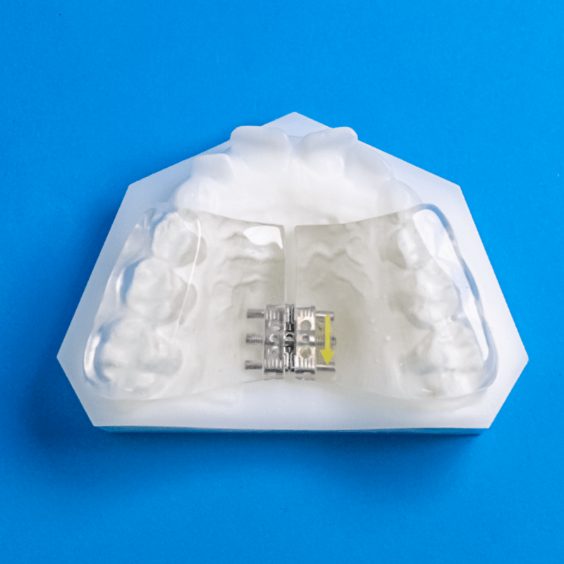 Haas - Ordont Orthodontic Appliance Lab