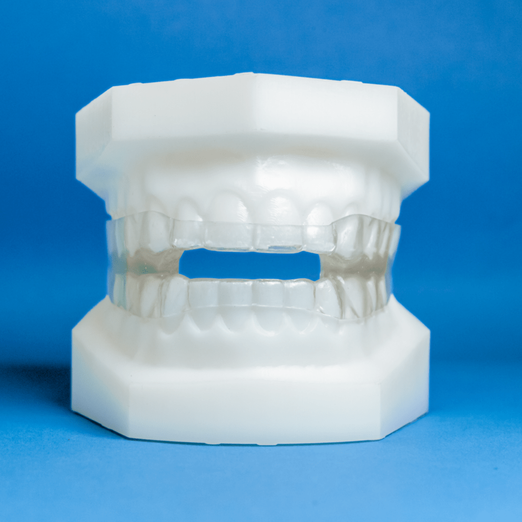 The Damon Splint - Ordont Orthodontic Appliance Lab