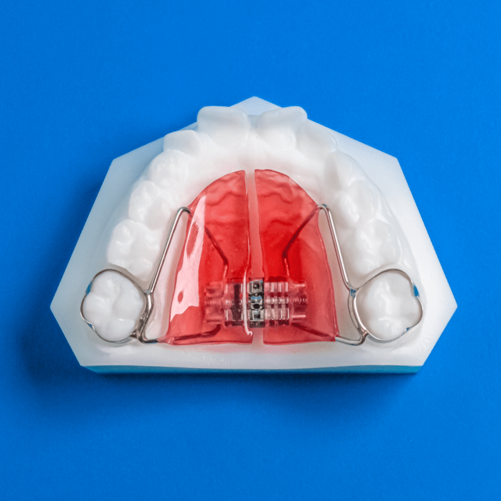 Haas - Ordont Orthodontic Appliance Lab