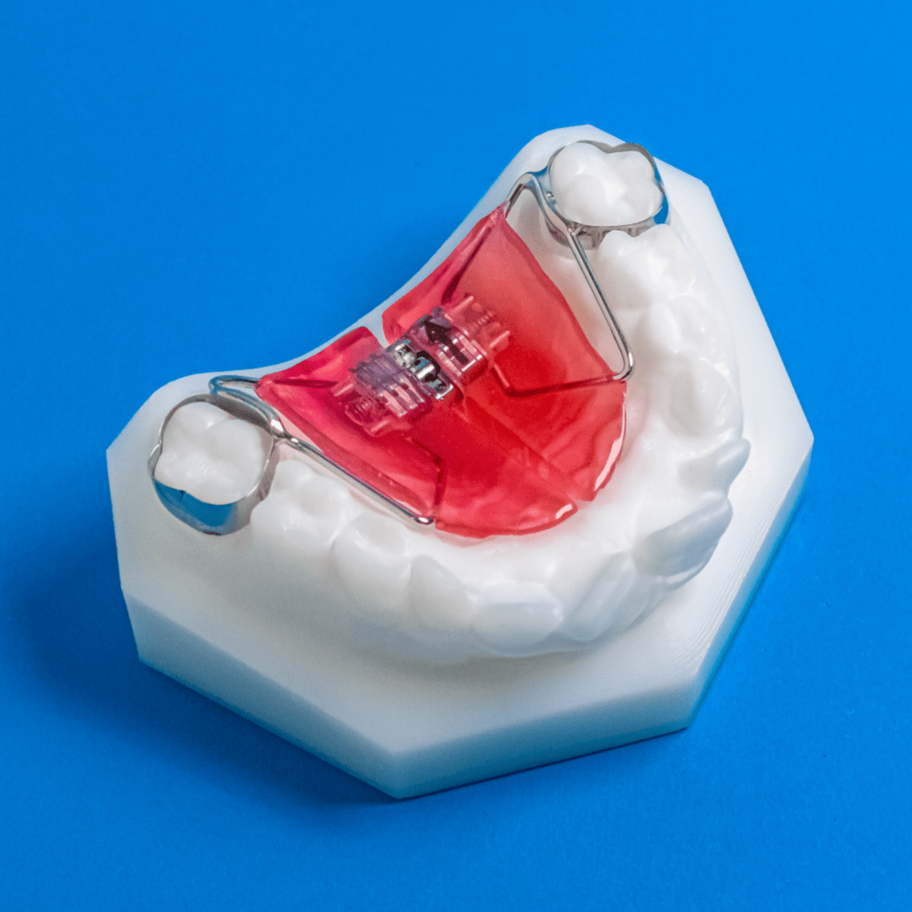 Haas - Ordont Orthodontic Appliance Lab