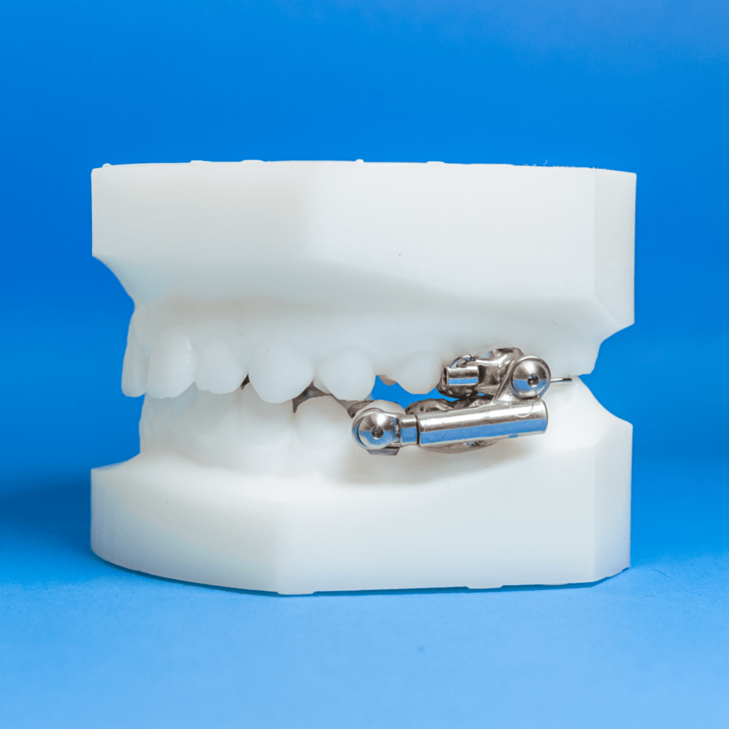 Pendex - Ordont Orthodontic Appliance Lab