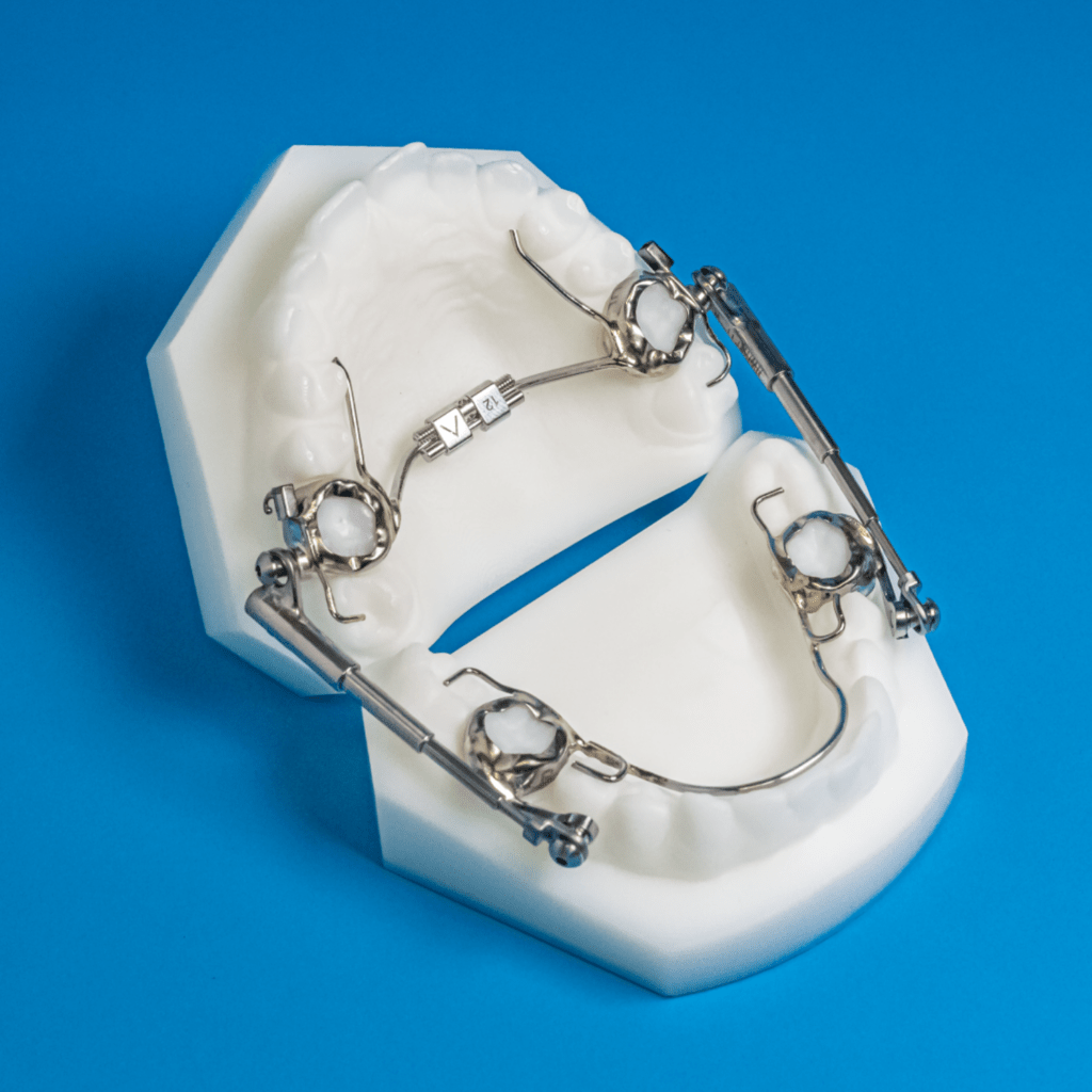 Specialty M4® Herbst - Ordont Orthodontic Appliance Lab