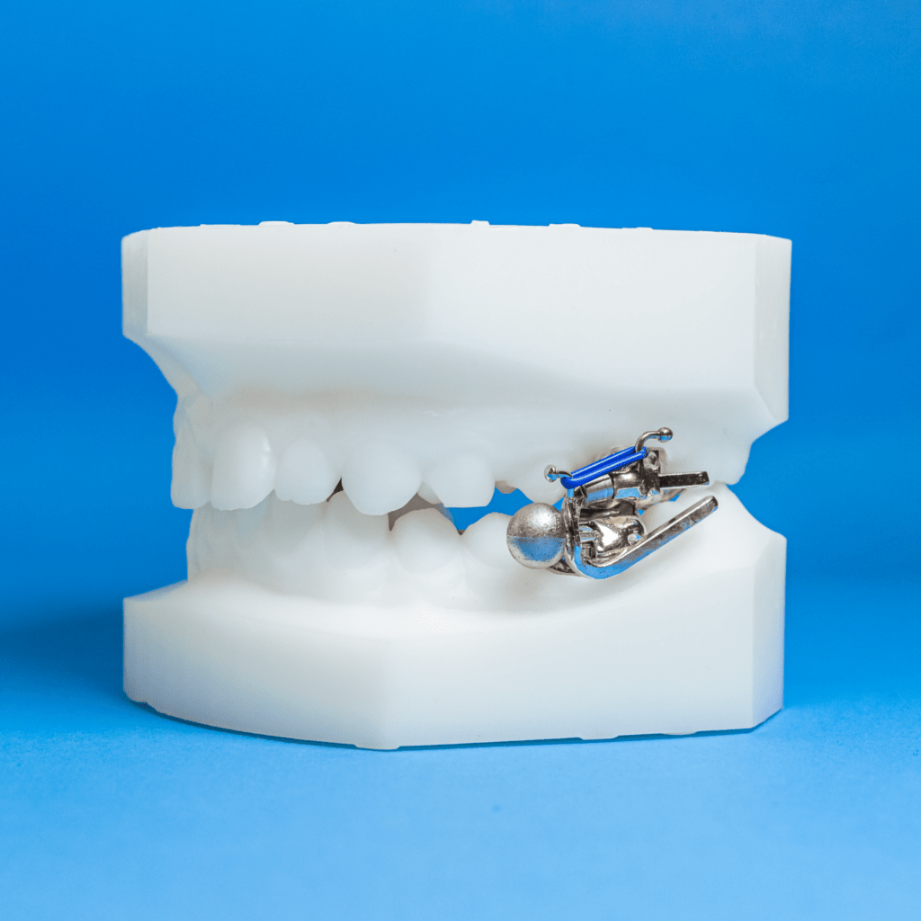 MARA - Ordont Orthodontic Appliance Lab
