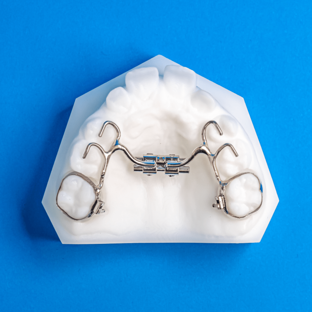 Pendex - Ordont Orthodontic Appliance Lab