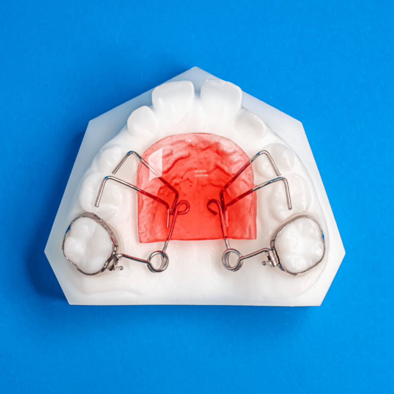 Pendex - Ordont Orthodontic Appliance Lab