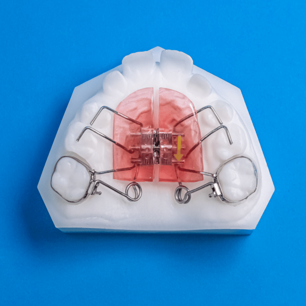 Pendex - Ordont Orthodontic Appliance Lab