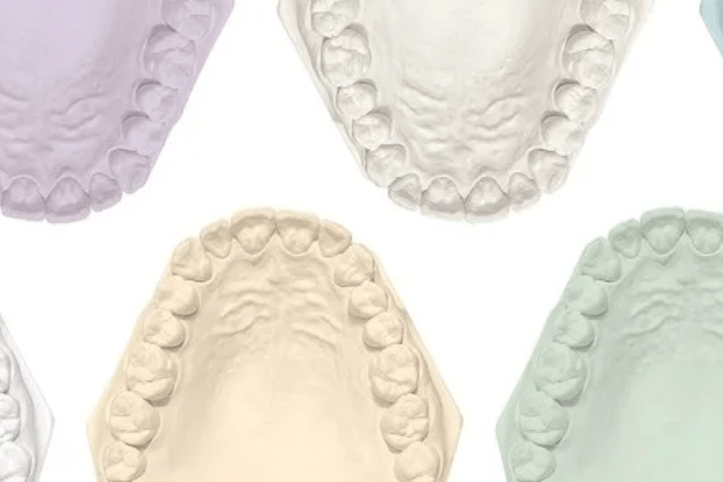 How to Submit a Stone Model / Impression Case | Ordont