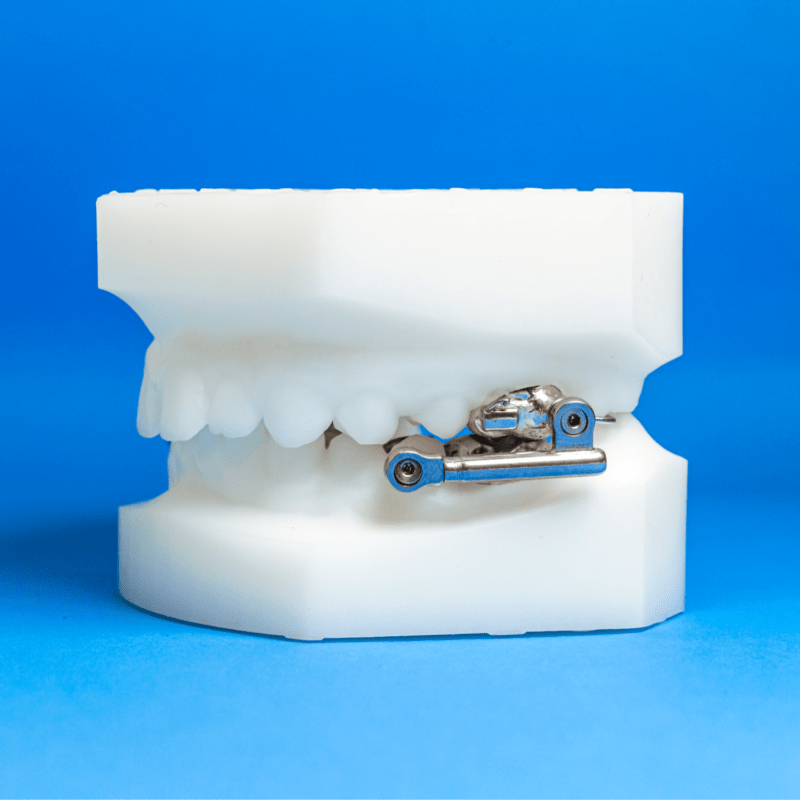 Pendex - Ordont Orthodontic Appliance Lab