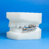 Pendex - Ordont Orthodontic Appliance Lab